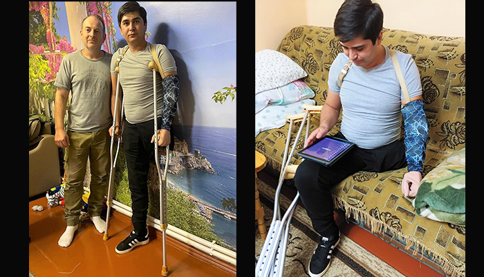 Armenian Worldwide, Rom Musaelyan needs Your help lost his left arm and ...